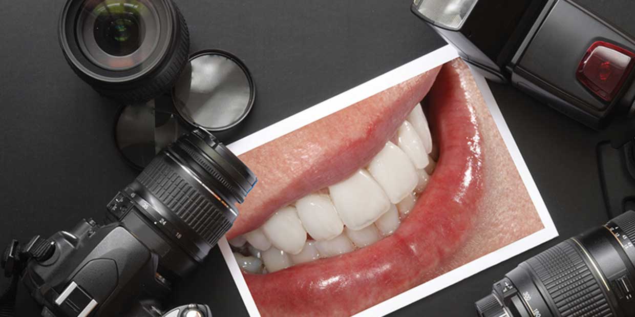 Dental Photography: An Insight into Its Benefits and Techniques - Dentalkart