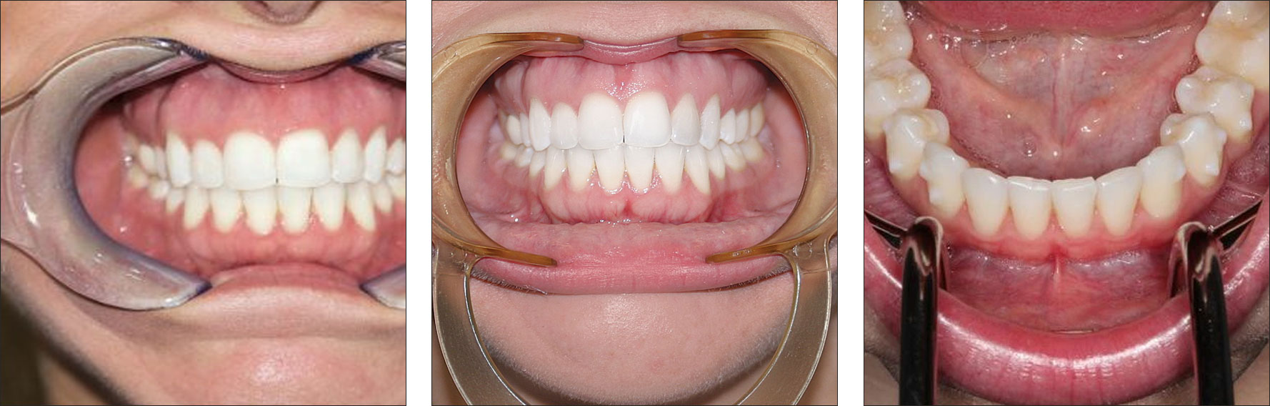 Dental Photography: An Insight into Its Benefits and Techniques ...