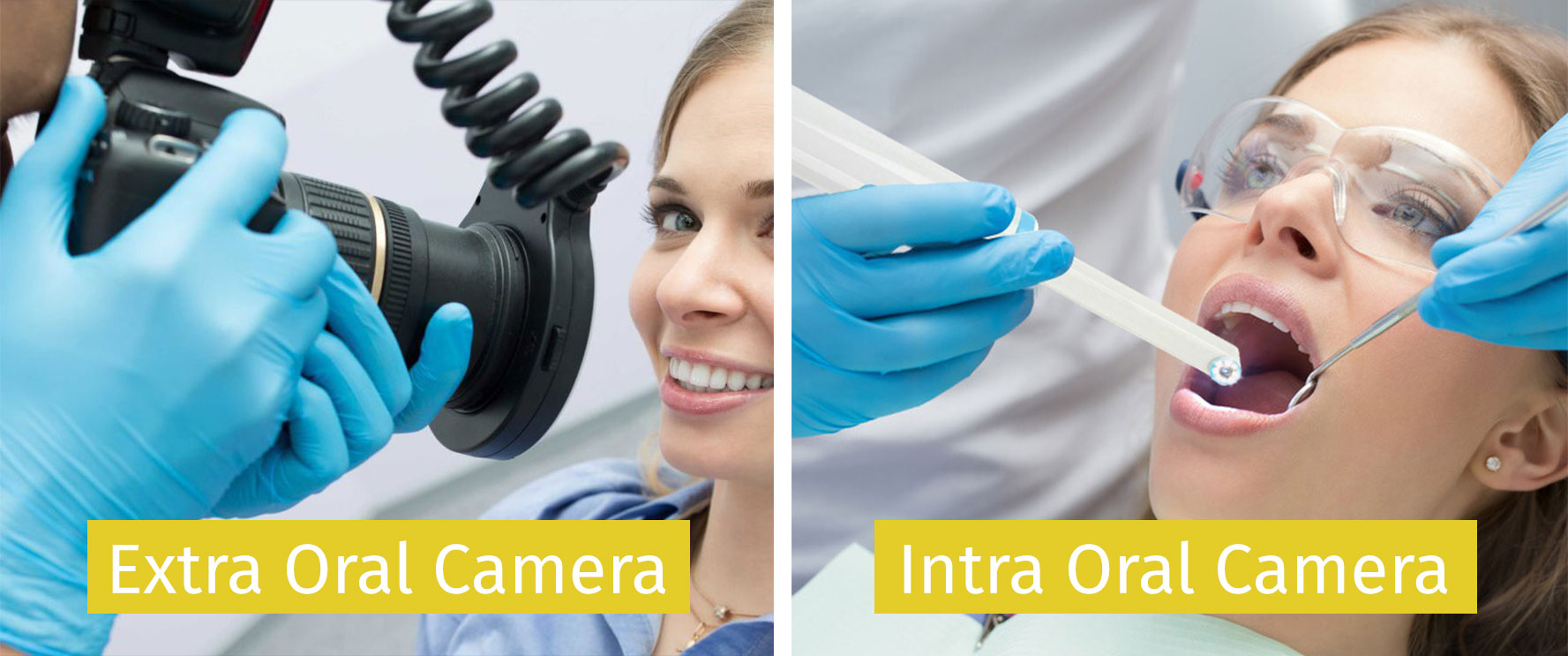 Dental Photography: An Insight into Its Benefits and Techniques - Dentalkart