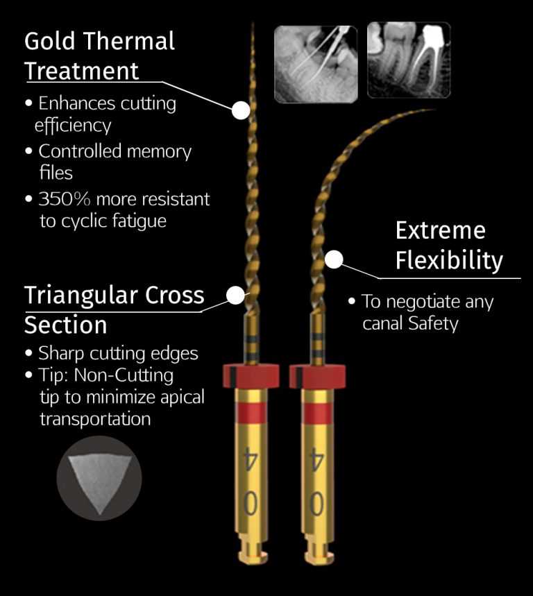 5 Best Endo Rotary Files - Dentalkart