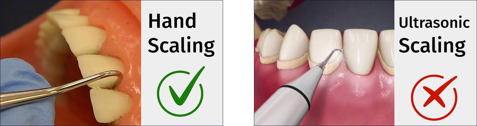 Asepsis of Dental Clinic During Covid-19 - Dentalkart