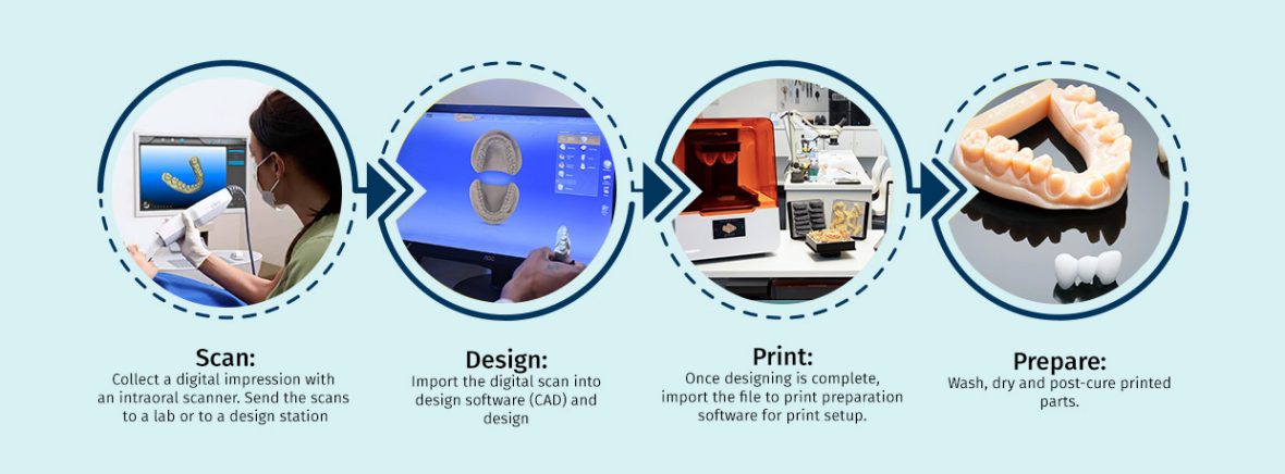 3D Printing Process - Dentalkart