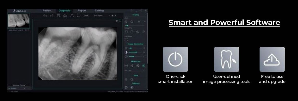 Woodpecker i-Sensor RVG: A New Era in Dental Radiography? - Dentalkart
