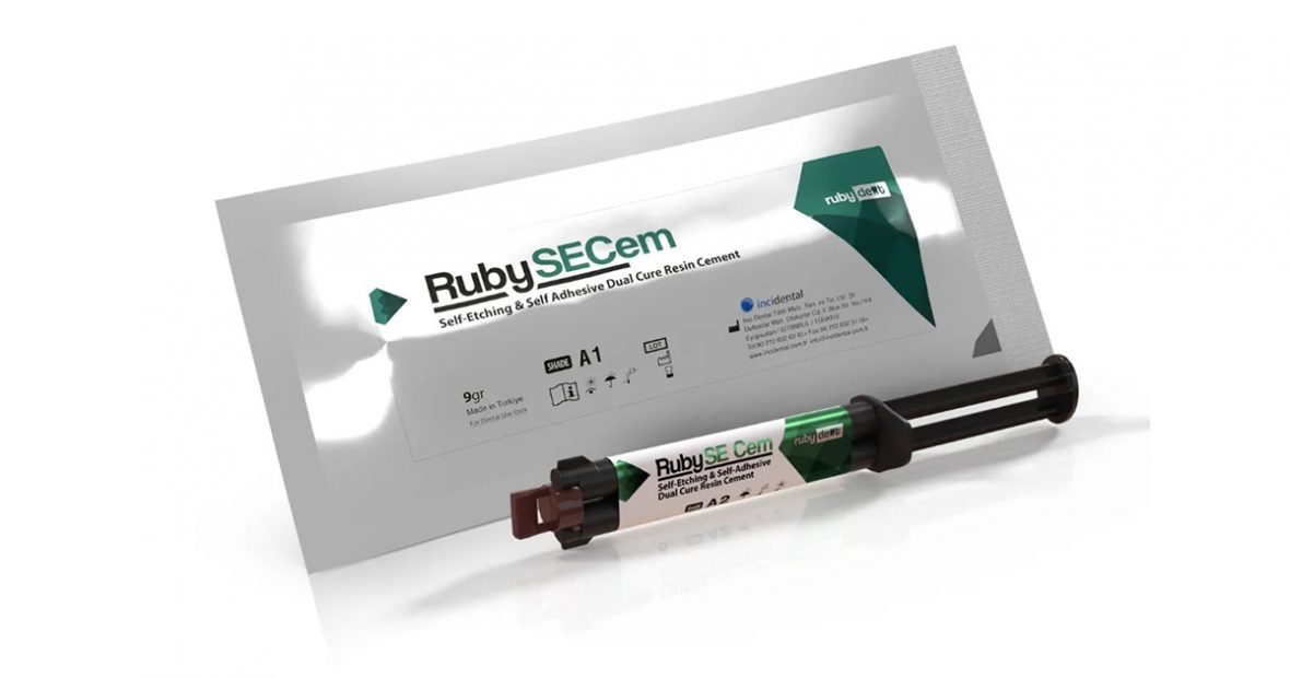 Dental Cements: Types, Uses and Top Picks for Restorations