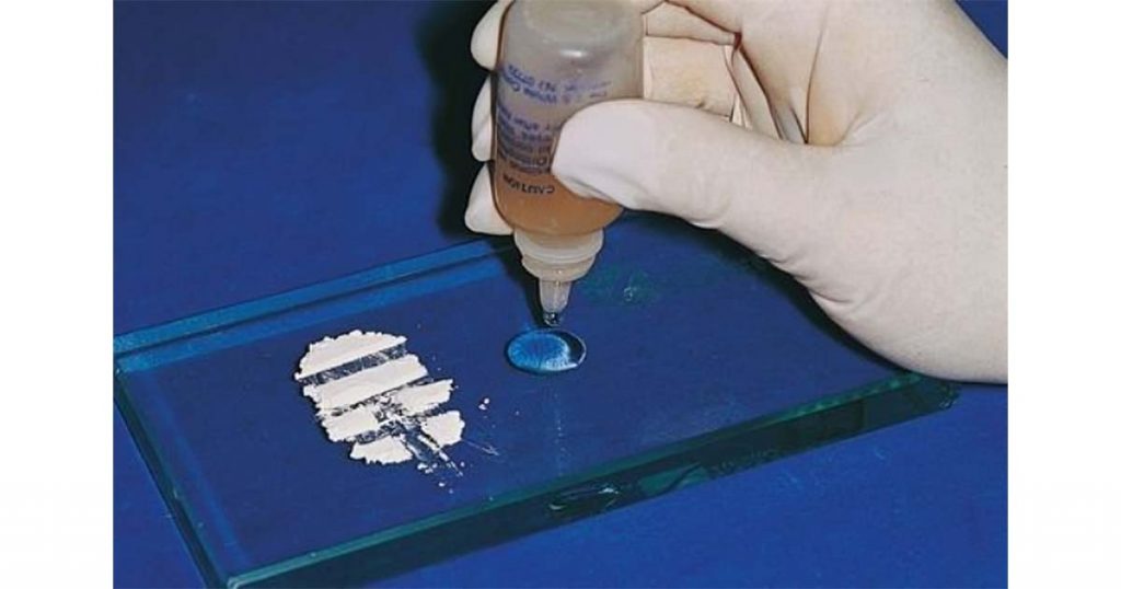 Dental Cements: Types, Uses and Top Picks for Restorations