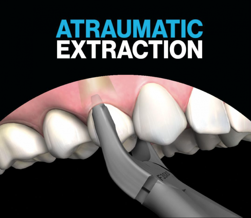 Atraumatic Extraction Procedure: A Comprehensive Guide to Minimally Invasive Tooth Removal