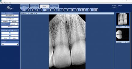 Advantages of RVG in Dentistry - Dentalkart