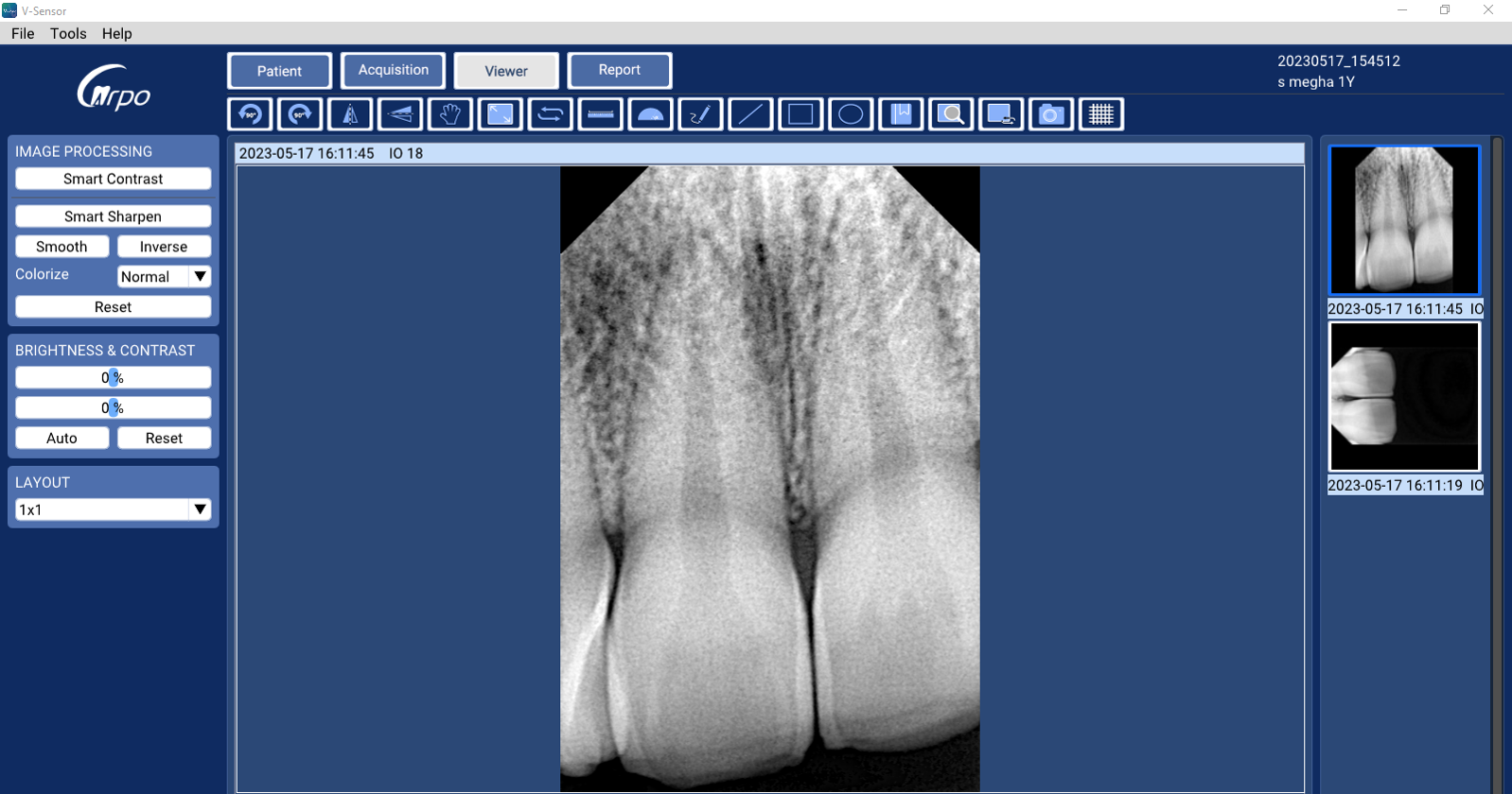 Advantages of RVG in Dentistry - Dentalkart