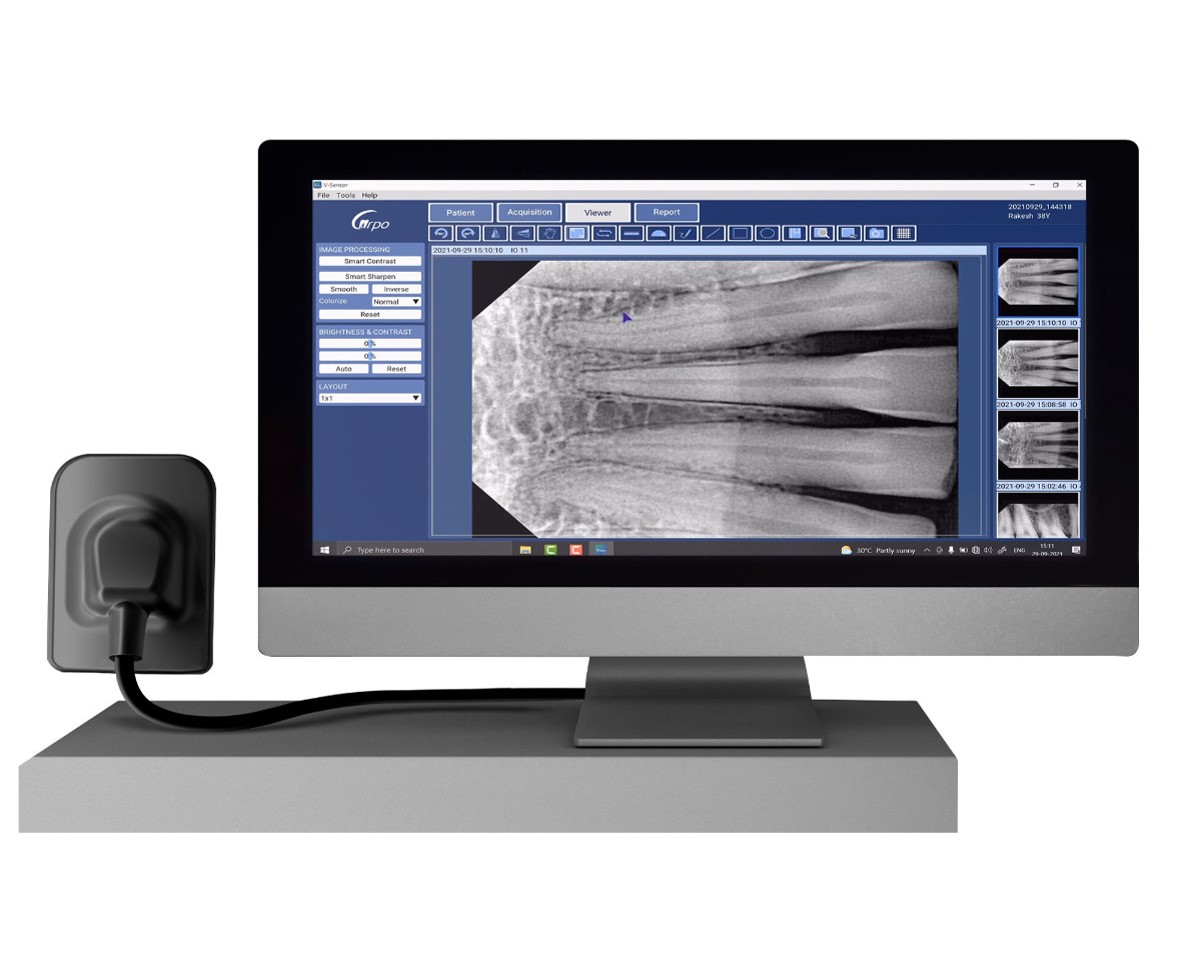 Advantages of RVG in Dentistry - Dentalkart