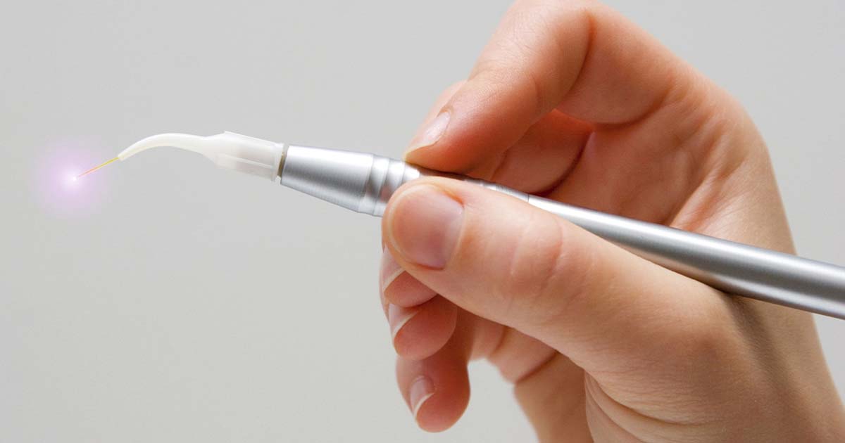 Laser Dentistry: Benefits, Applications, and Types - Dentalkart