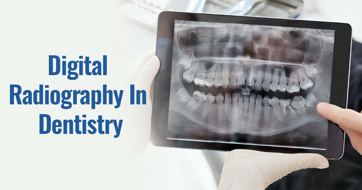 Digital Radiography in Dentistry - Dentalkart