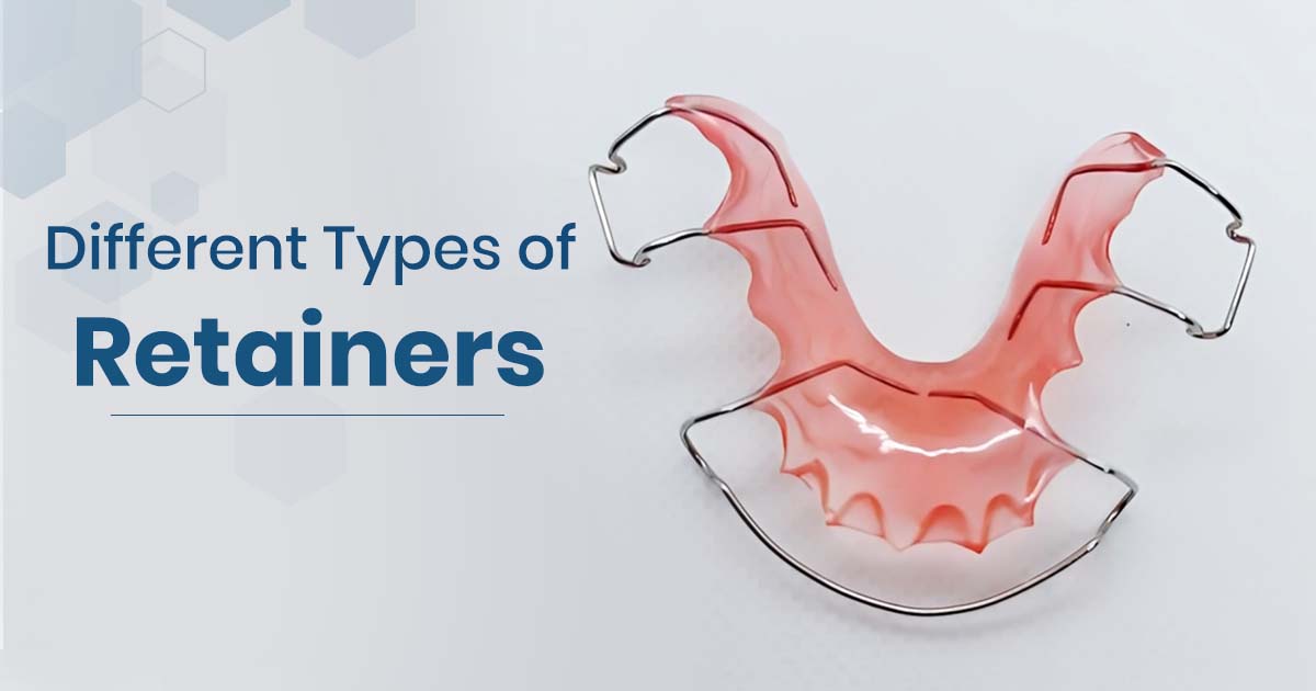Types of Retainers in Dentistry: Removable Vs Permanent - Dentalkart