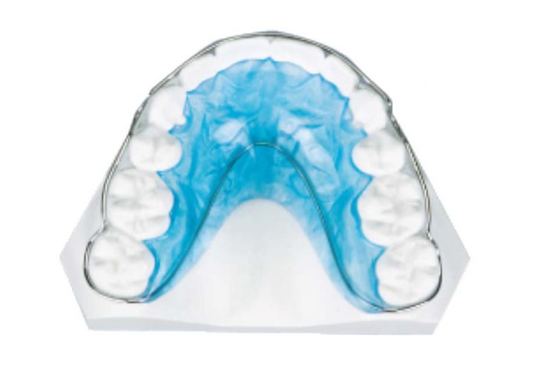 Types of Retainers in Dentistry: Removable Vs Permanent - Dentalkart