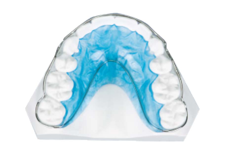 Types of Retainers in Dentistry: Removable Vs Permanent - Dentalkart