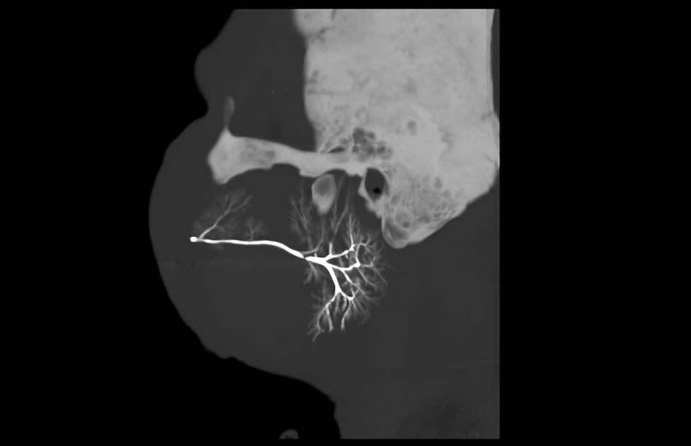 Digital Radiography in Dentistry - Dentalkart