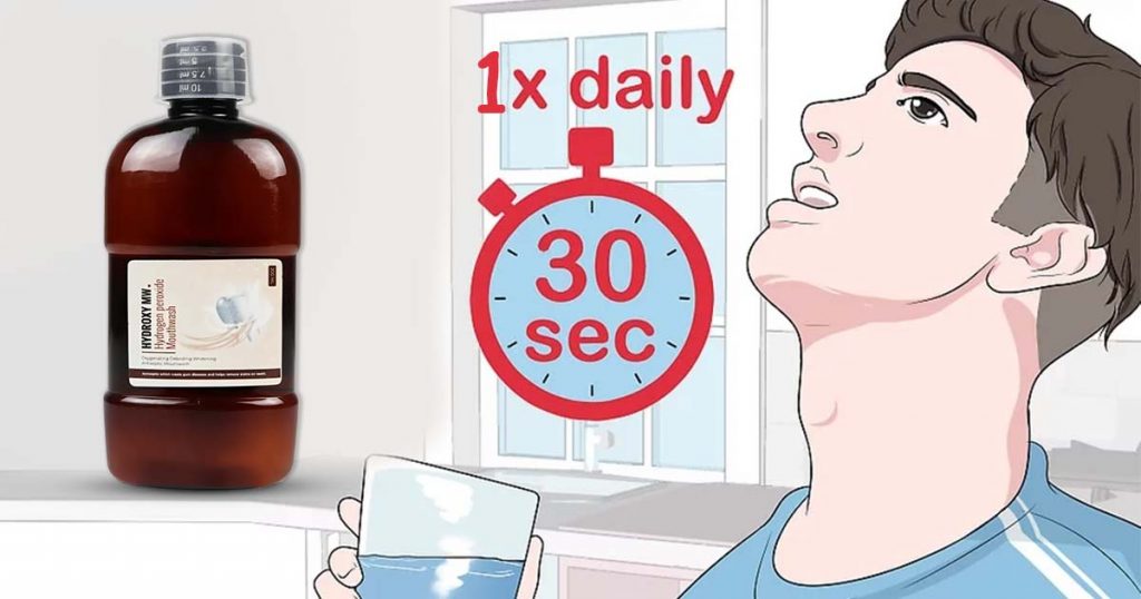 Hydrogen Peroxide Mouthwash: Uses, Benefits and Side Effects - Dentalkart