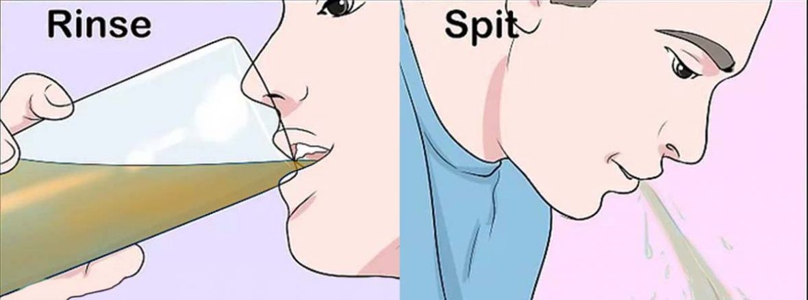 Hydrogen Peroxide Mouthwash: Uses, Benefits and Side Effects - Dentalkart