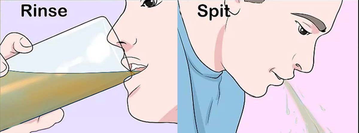 Hydrogen Peroxide Mouthwash: Uses, Benefits and Side Effects - Dentalkart