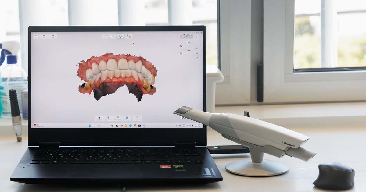 Intraoral Scanners: Applications, Benefits & Characteristics