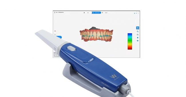 Intraoral Scanners: Applications, Benefits & Characteristics