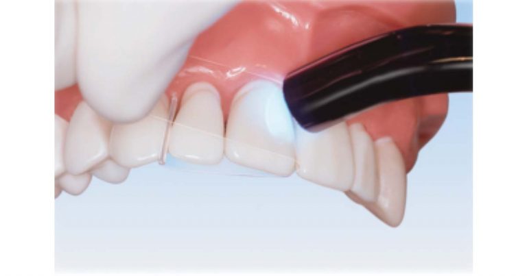 Types of Dental Matrix Systems | Role of Matrix in Dentistry