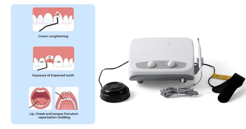 Electrosurgery in Dentistry: Techniques, Benefits, and Best Practices ...