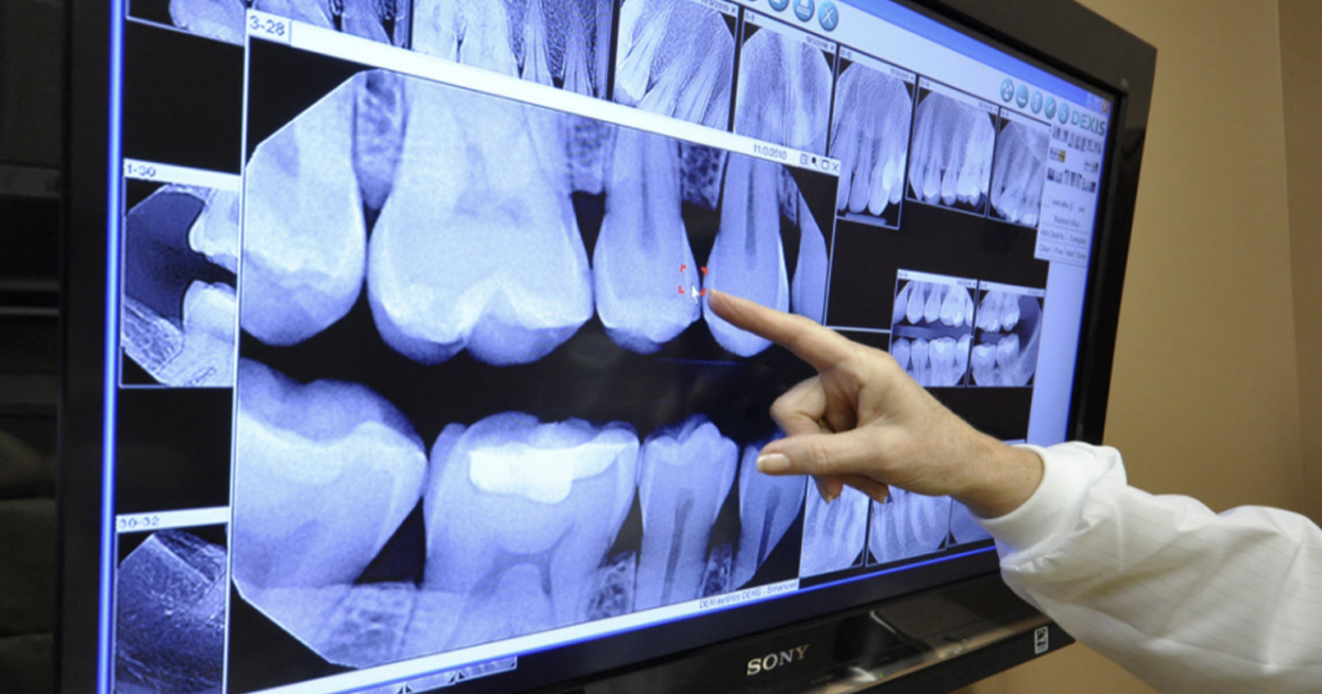 Digital Radiography: 8 Reasons It’s Worth the Transition - Dentalkart