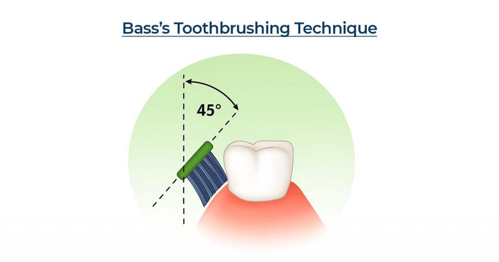Toothbrushing Techniques: Choosing the Best Method for Patients