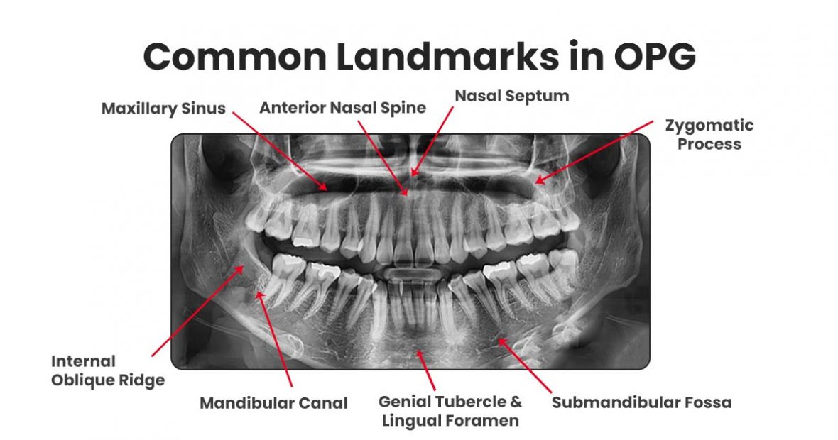 How to Read Dental X-Rays: Beginner’s Guide