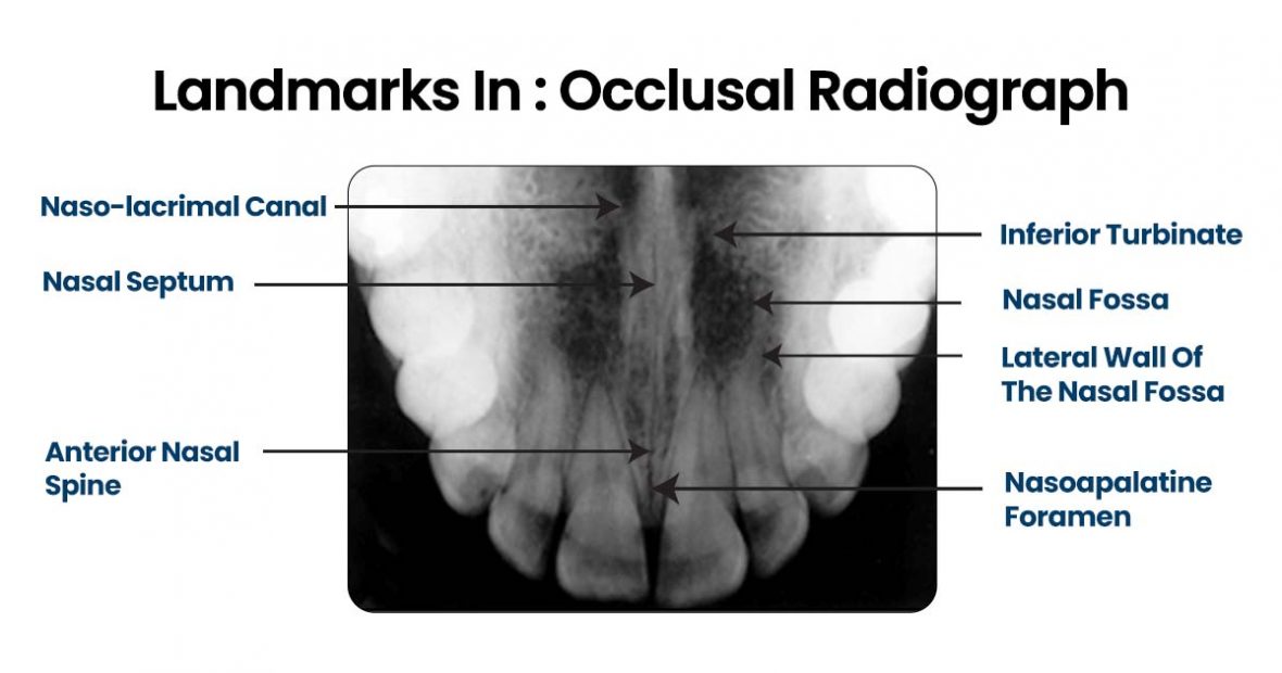 How to Read Dental X-Rays: Beginner’s Guide