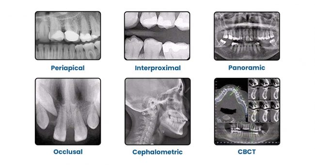 How to Read Dental X-Rays: Beginner’s Guide