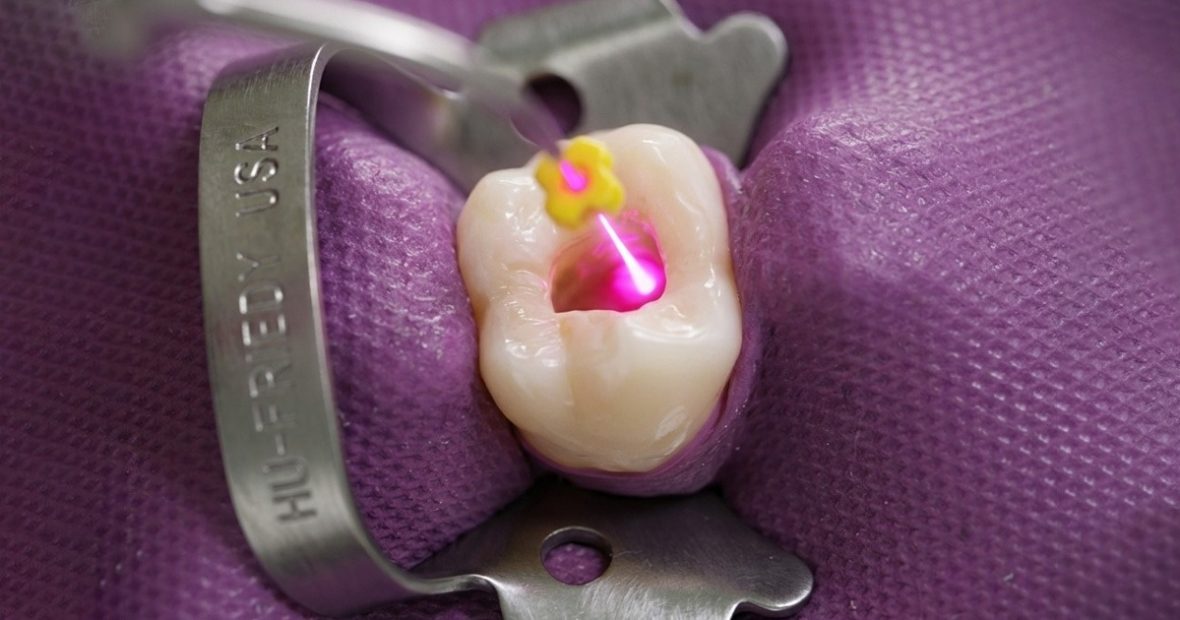 Dental Trauma: Clinical Guide to Ellis Classification & Management